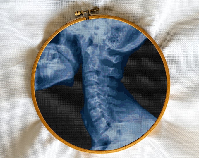 X-ray, Neck, Spine, Human, Doctor, Health, Roentgenography, Medic ...
