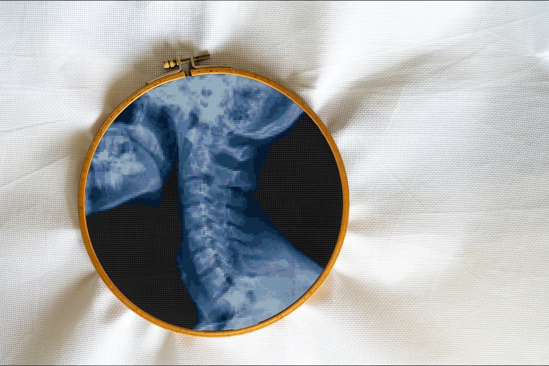 X-ray, Neck, Spine, Human, Doctor, Health, Roentgenography, Medic ...