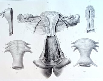 Uterus Dissection - Etsy UK