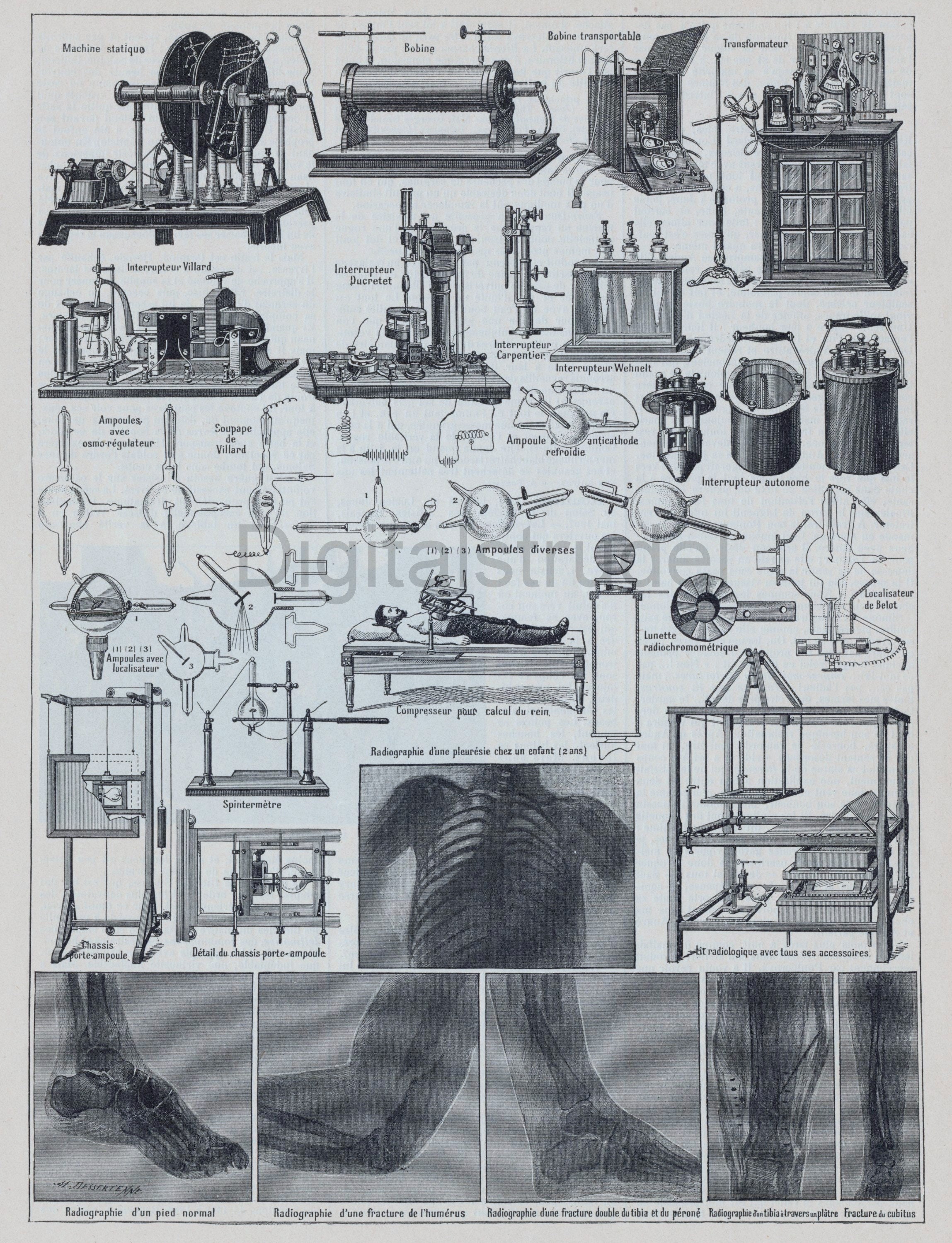 1907 Antique Print of Radiography - X-ray Equipment - Medical ...