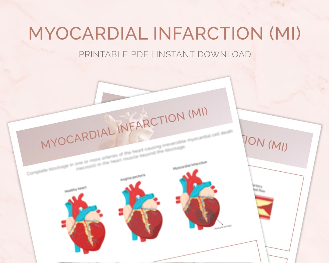 Myocardial Infarction Study Guide | Heart Attack Nursing Study Guides ...