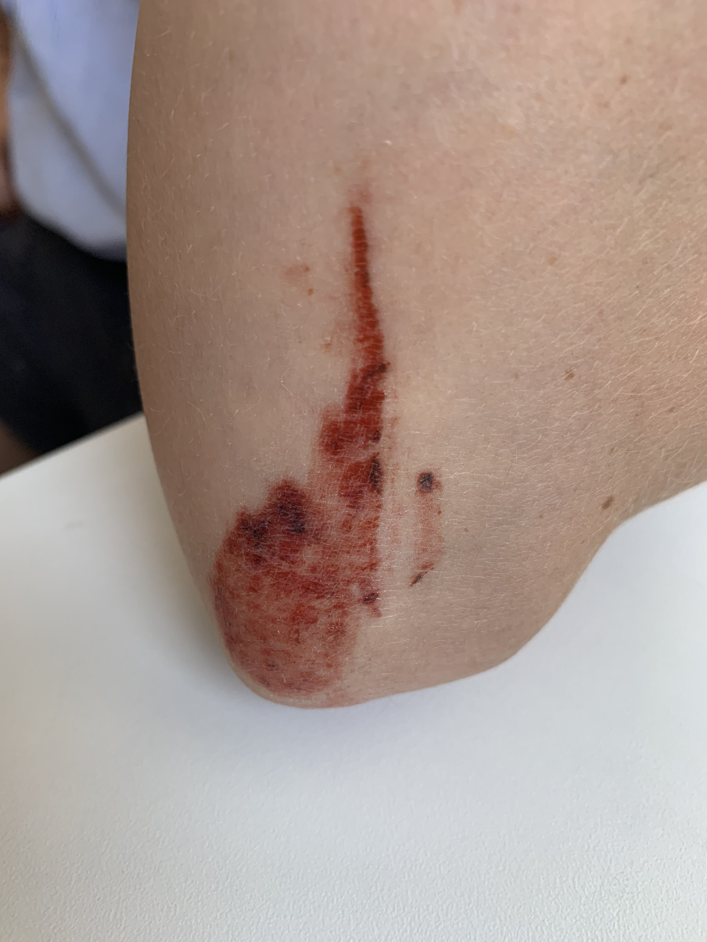 Temporary Tattoo - Skin Scrapes 2 - SFX Tattoo - Etsy