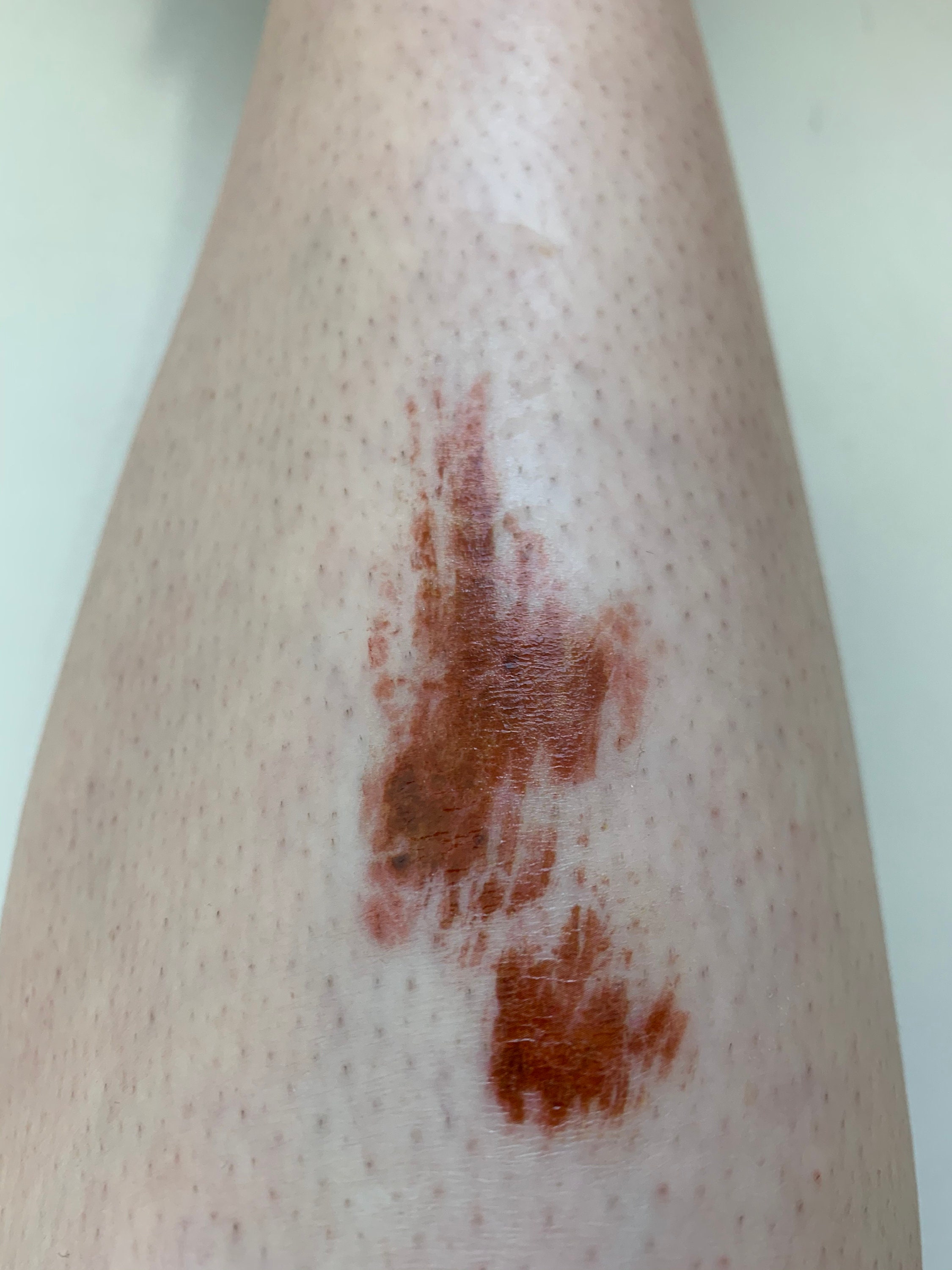 Temporary Tattoo - Skin Scrapes 2 - SFX Tattoo - Etsy