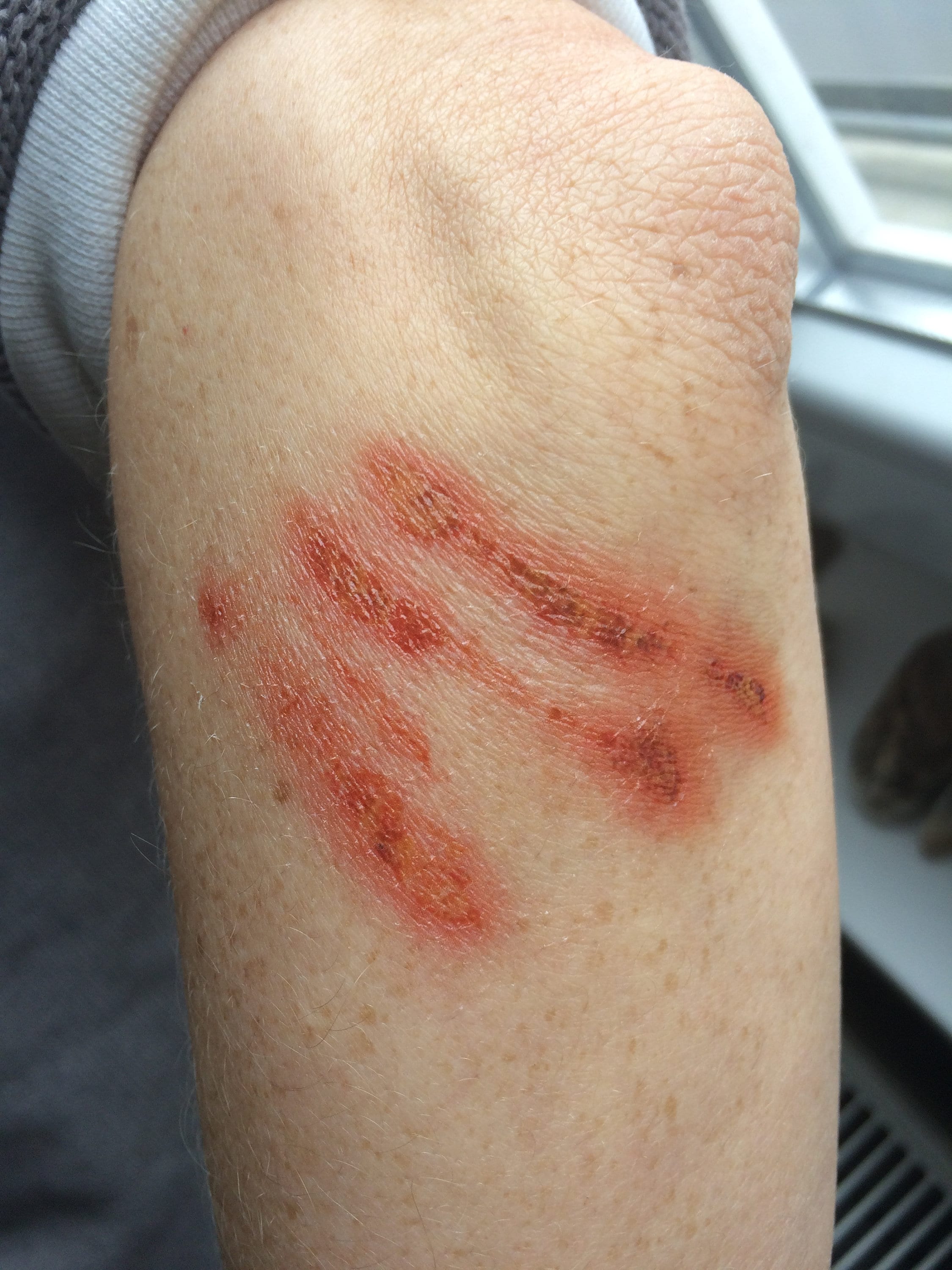 Temporary Tattoo - Random Wounds 1 - SFX Tattoo - Etsy
