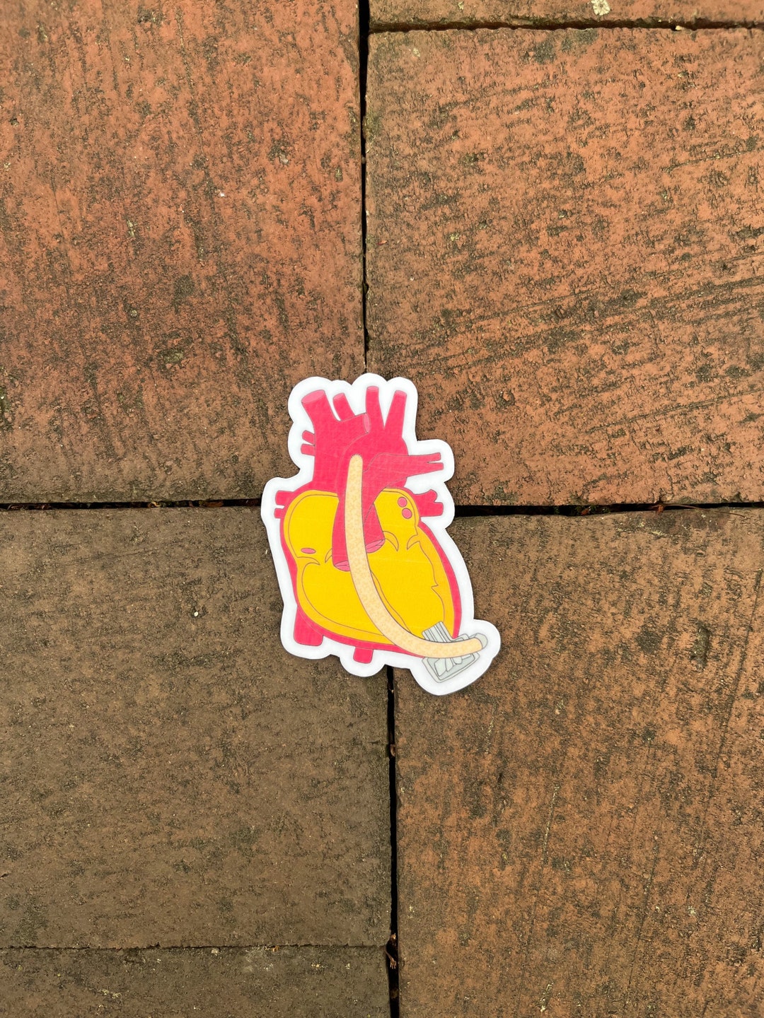 Heartmate 3 Sticker/ Anatomical Heart Sticker/ LVAD Sticker/ Vinyl ...