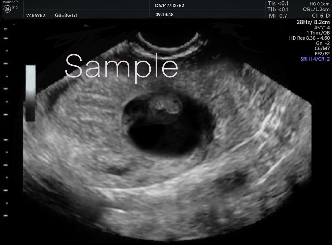 Ultrasound Digital Download Png Jpeg Real Ultrasound Prank, Gag Gift ...