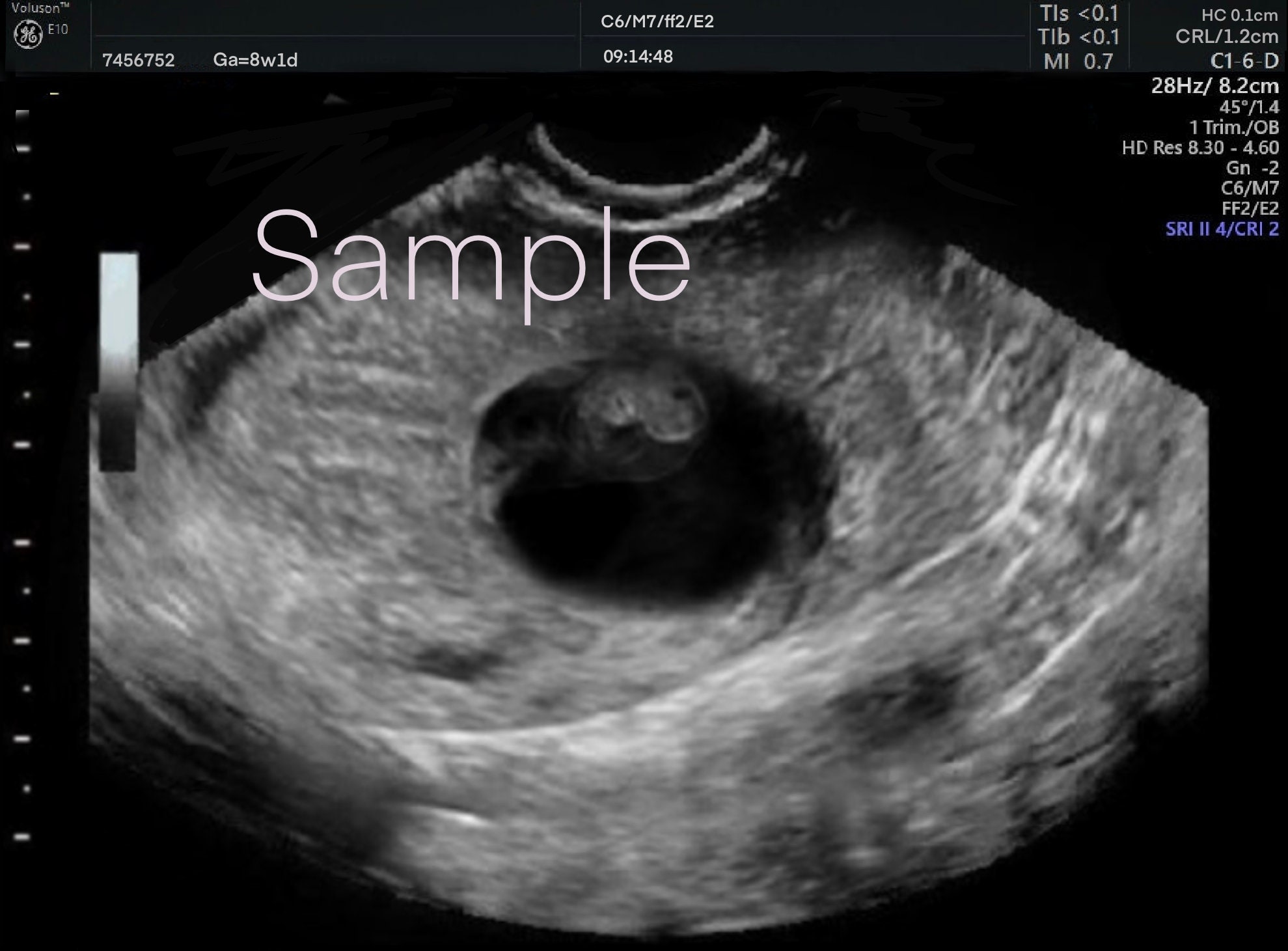 Ultrasound Digital Download Png Jpeg Real Ultrasound Prank, Gag Gift ...