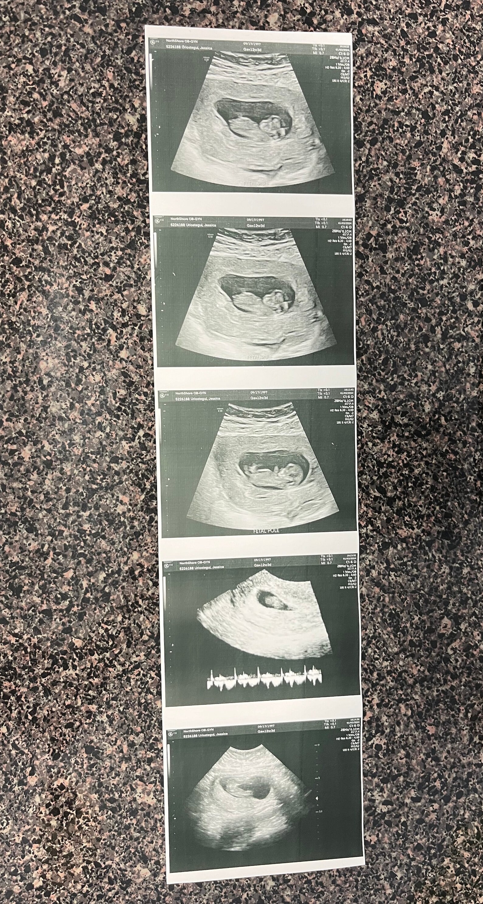 Ultrasound Prints,fake Ultrasound, Real Prints, Pregnancy Announcement ...