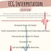 Basic ECG Overview - Etsy