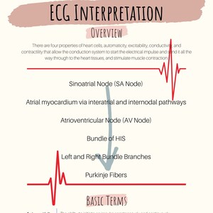 Basic ECG Overview - Etsy
