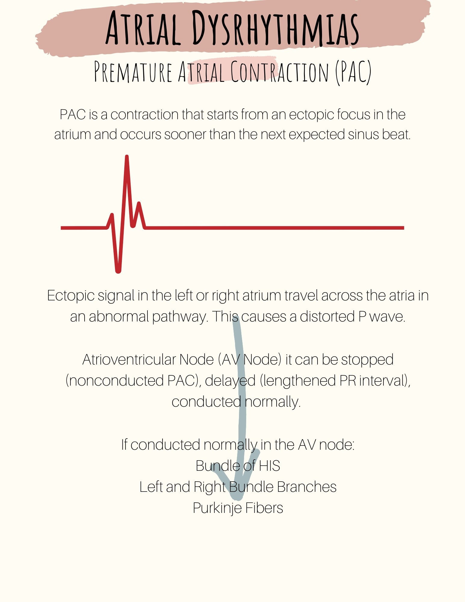 Premature Atrial Contraction