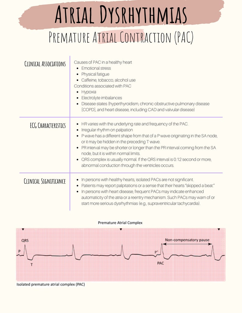 Atrial Dysrhythmias - Etsy