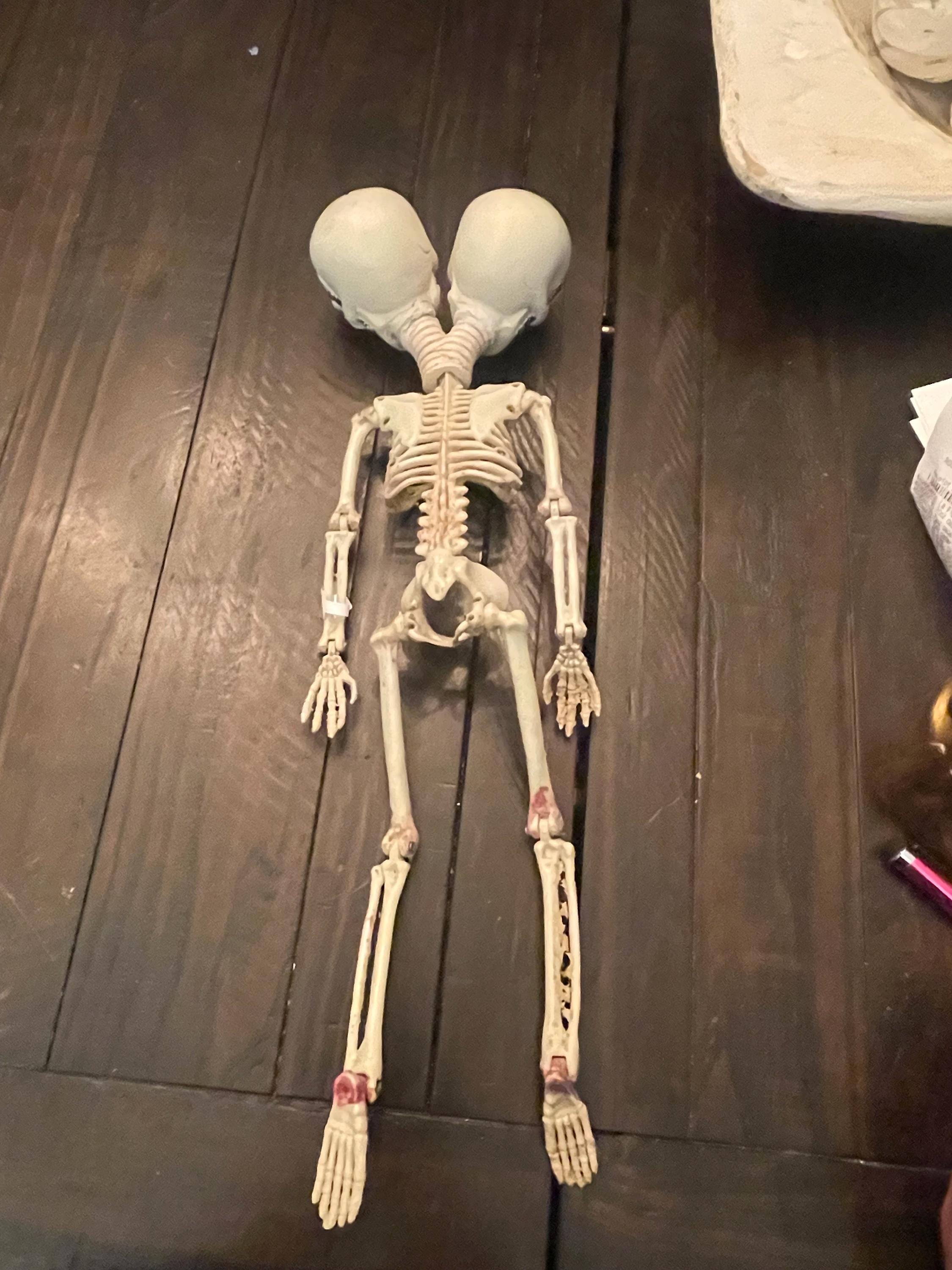 Double-headed Anatomy Skeletal Model Fetus, Skeleton, Skull, Bizarre ...