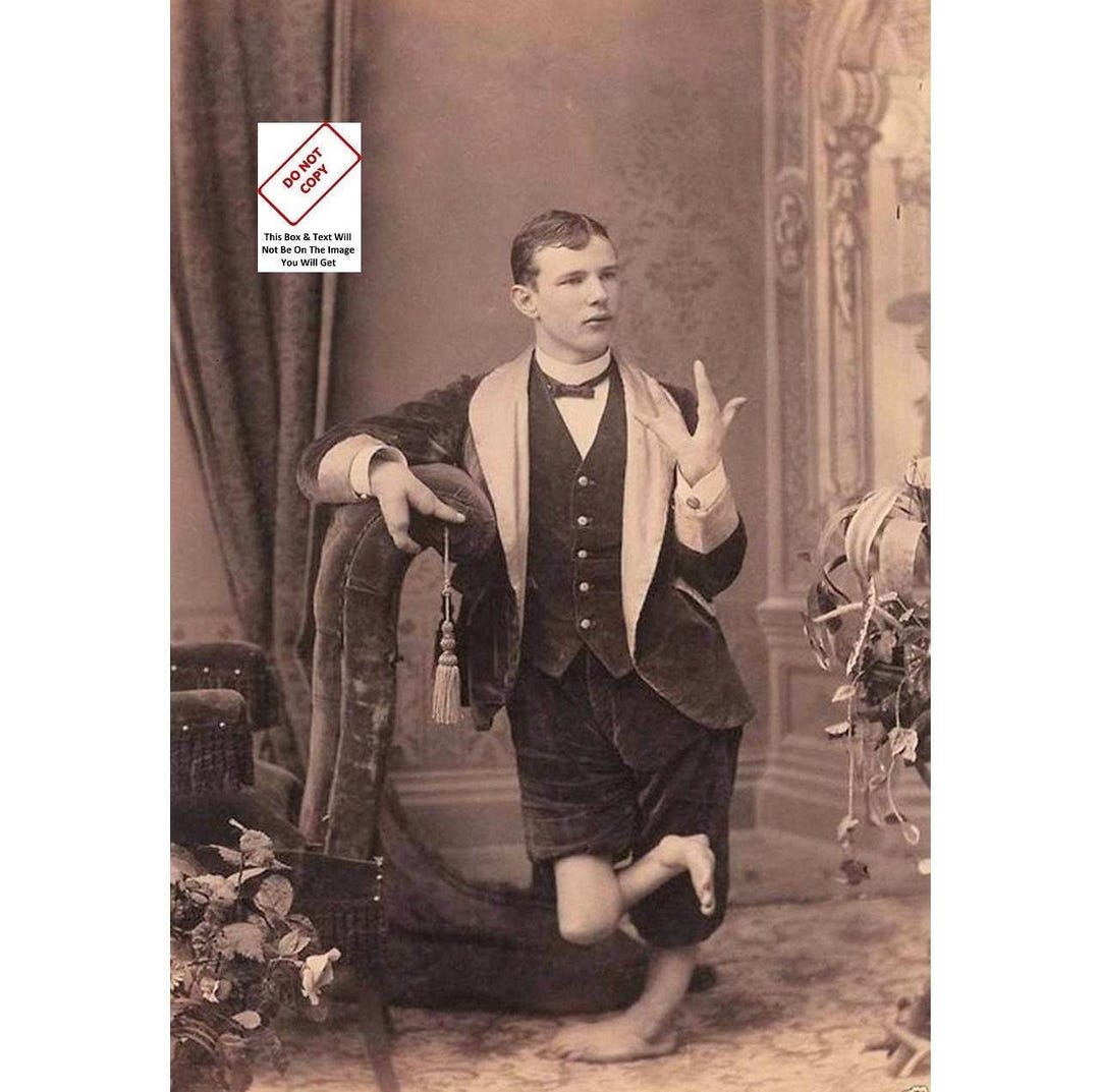 Creepy Lobster Boy Scary Sideshow Circus Freaky Child Strange Side Show ...