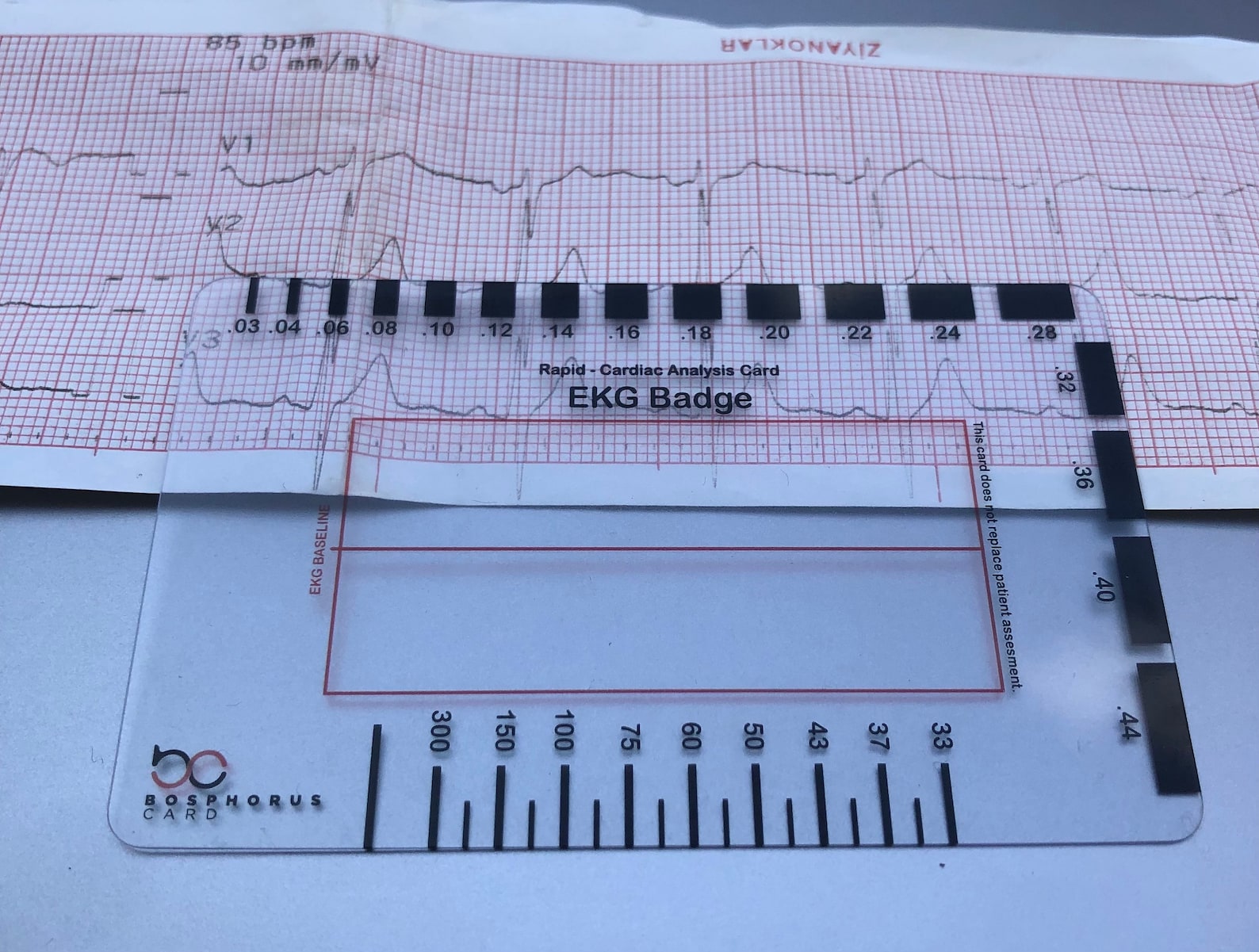 Rapid Cardiac Analysis Tool R-cat EKG Badge With Waterproof | Etsy UK
