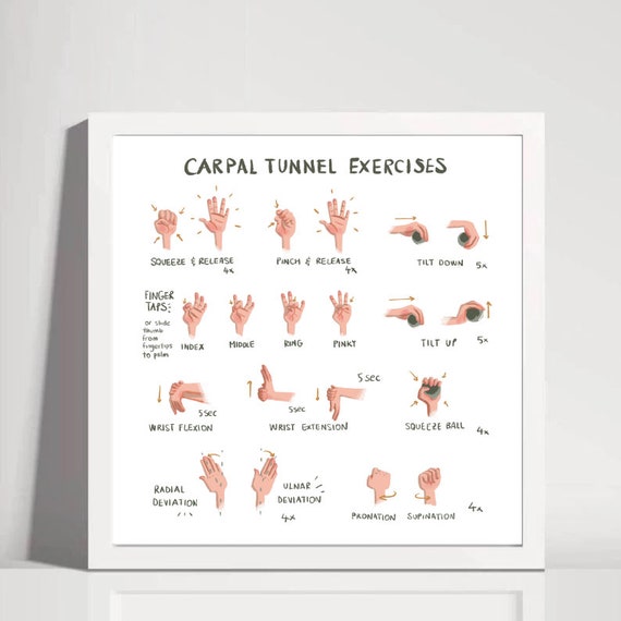 Carpal Tunnel Syndrome Exercises Pdf