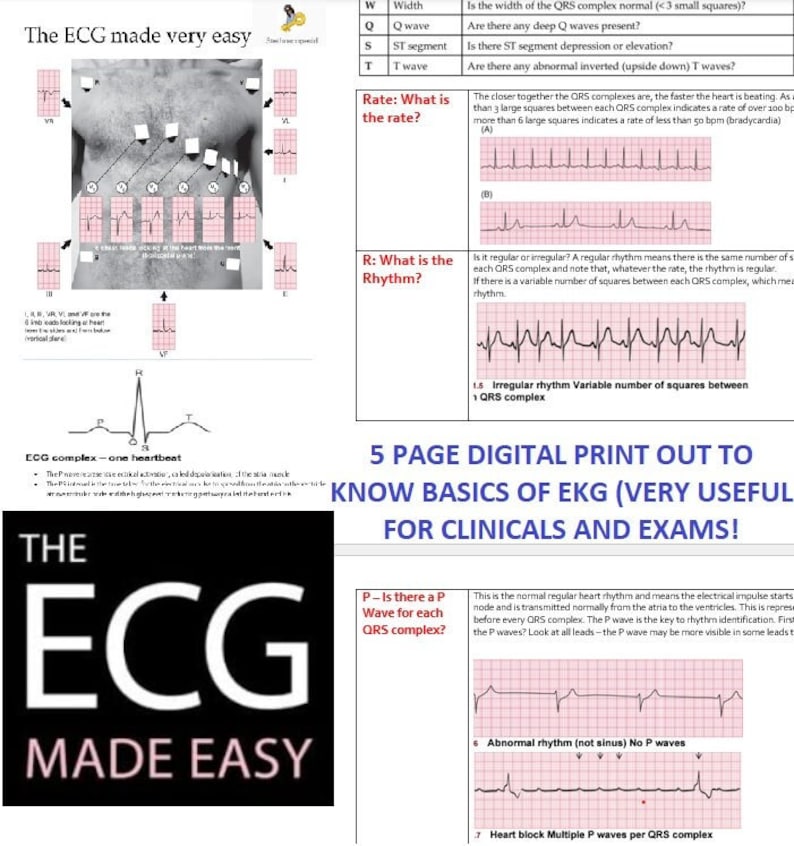 EKG MADE EASY for Nurses, Nurse Practitioner, Pa and Med Students Part 1: Know the Basics and ...