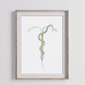 IUD Watercolor Print, Reproductive Rights Feminist Art - Etsy