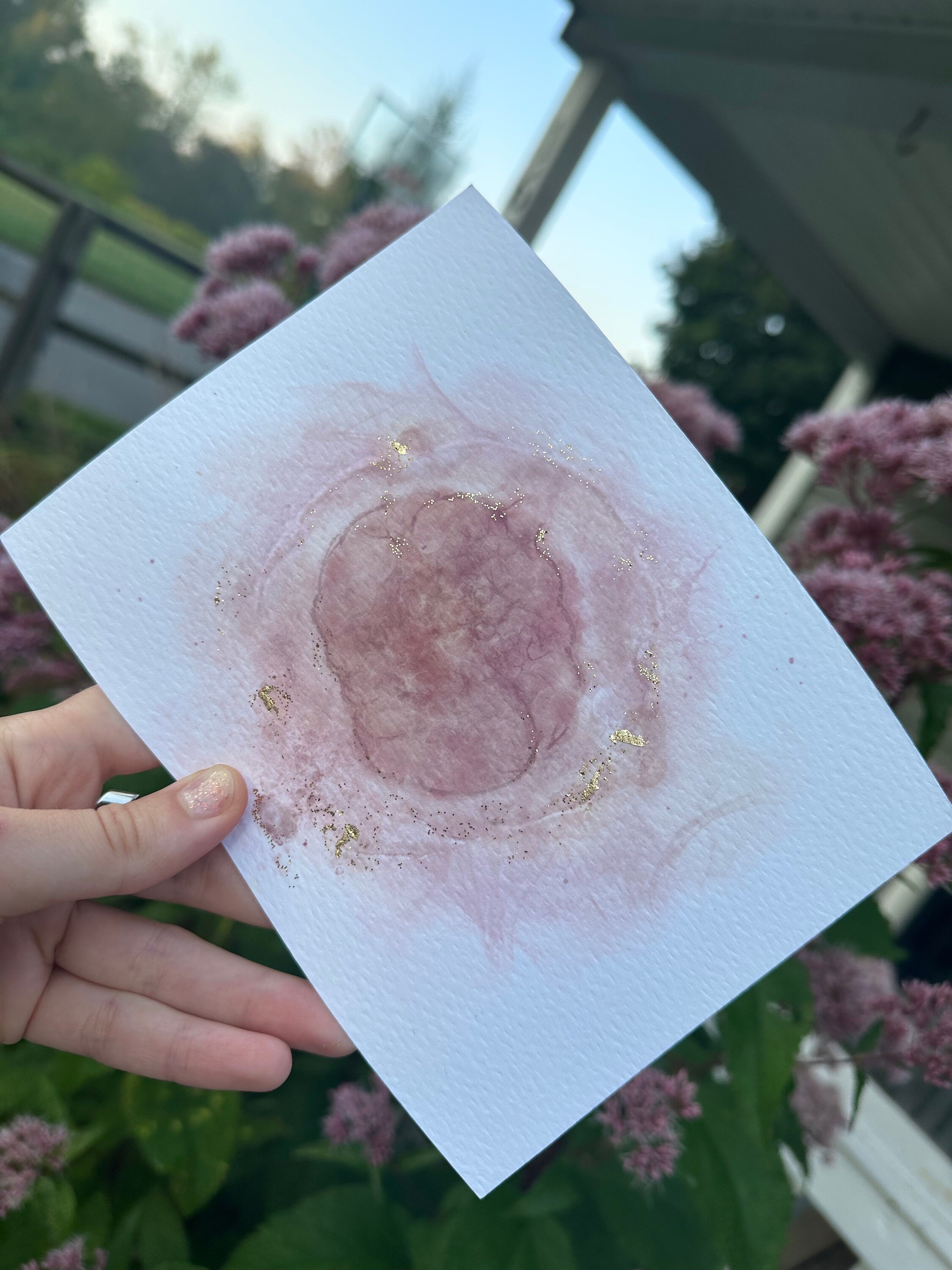 Custom Embryo Art, IVF Embryo Painting, IVF Embryo Art, Embryo ...