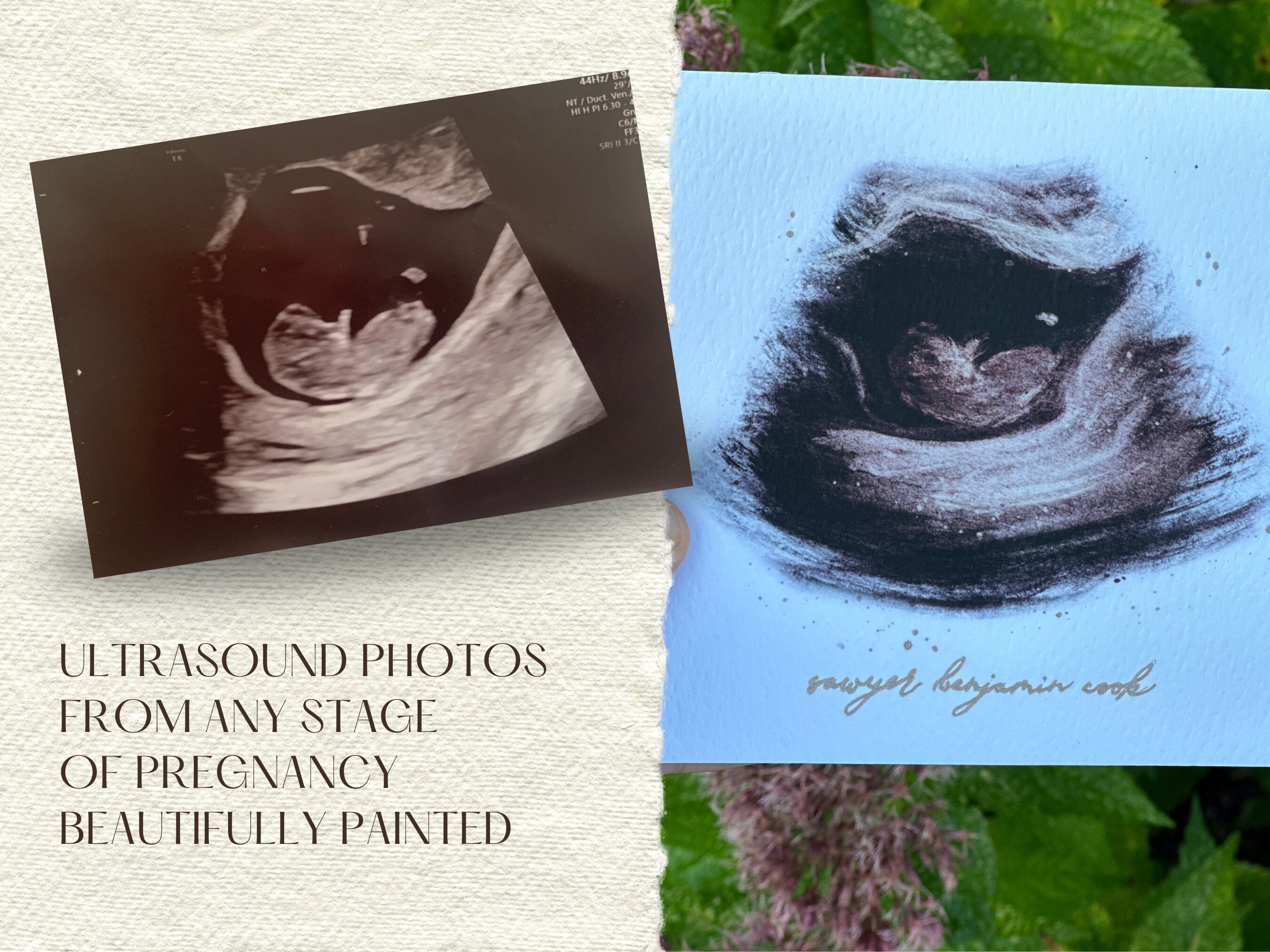 Custom Ultrasound Painting Ultrasound Painting Sonogram Art - Etsy