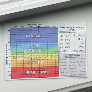 Audiology Cheat Sheet Magnet, Audiology, Grad School, Audiologist Gift ...