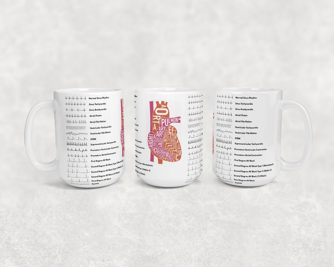 Cardiology Cardiac EKG ACLS | 15oz Ceramic Mug | Fun Gift for Nurses ...