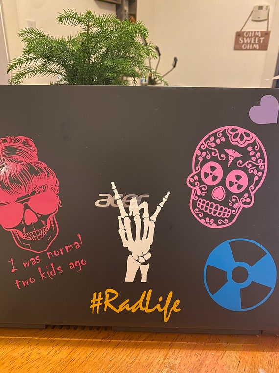 Rad Life Vinyl Decal Perfect Gift for Any Rad Tech or X-ray - Etsy