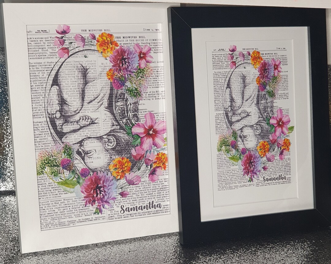 Midwife Print, Student Midwife Prints, Fetus, Foetus in Womb Prints ...