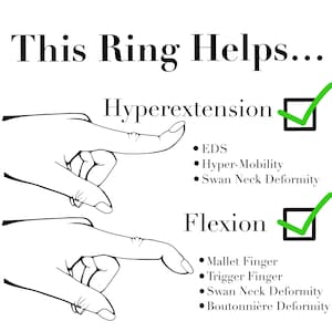 Adjustable Swan Ring | Finger Splint for Eds/arthritis | Joint ...