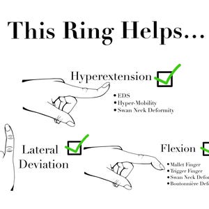 Full Finger Ring Splint | Eds/hypermobility | Mallet Finger | Trigger ...