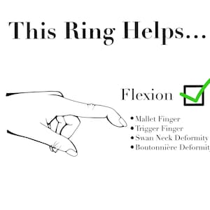 Decorative Mallet Ring Splint | Sterling Silver | EDS |arthritis ...