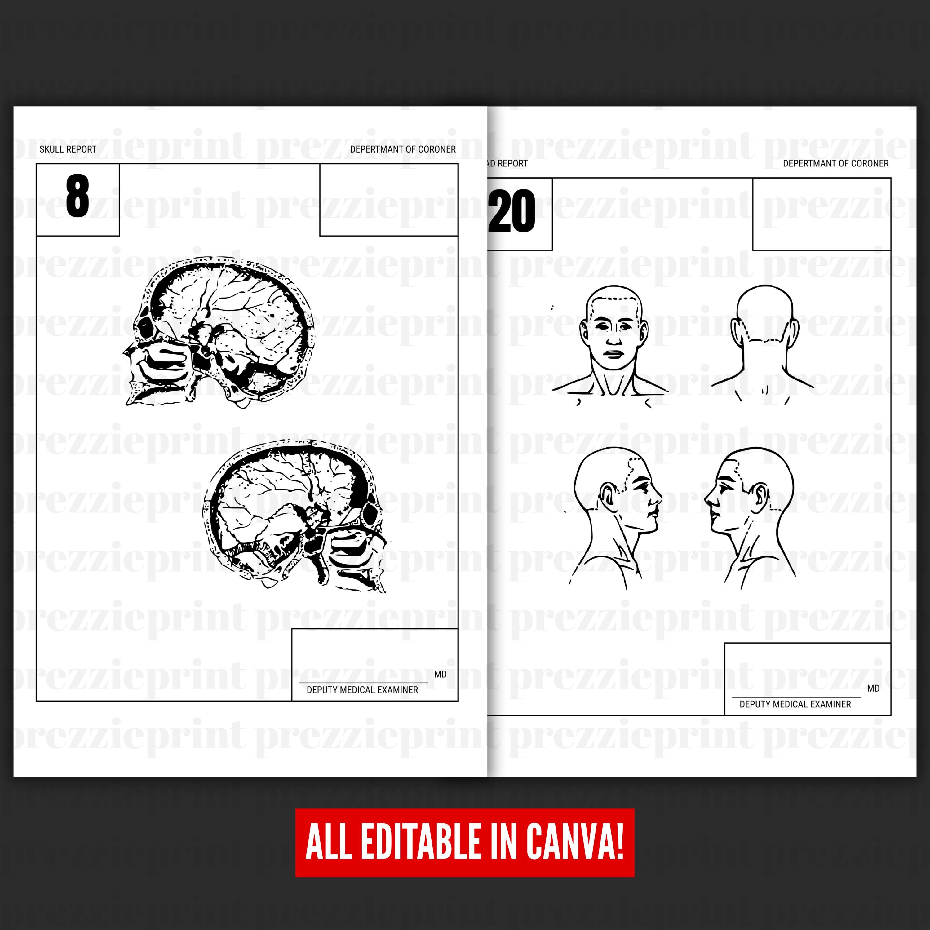 True Crime Case File – Custom Serial Killer Kit – Canva – Vintage Report – Template for DIY ...