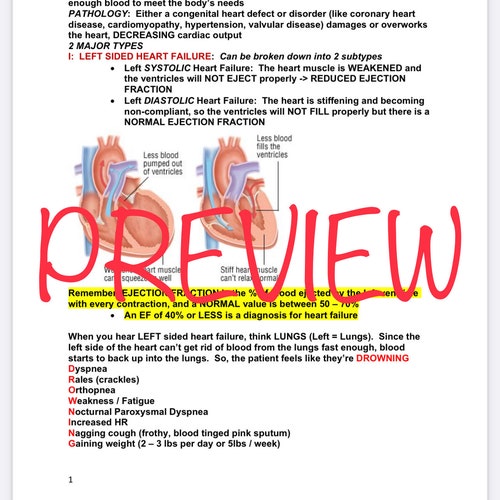 Cardiac Dysrhythmia Chart Med Surg Etsy Canada