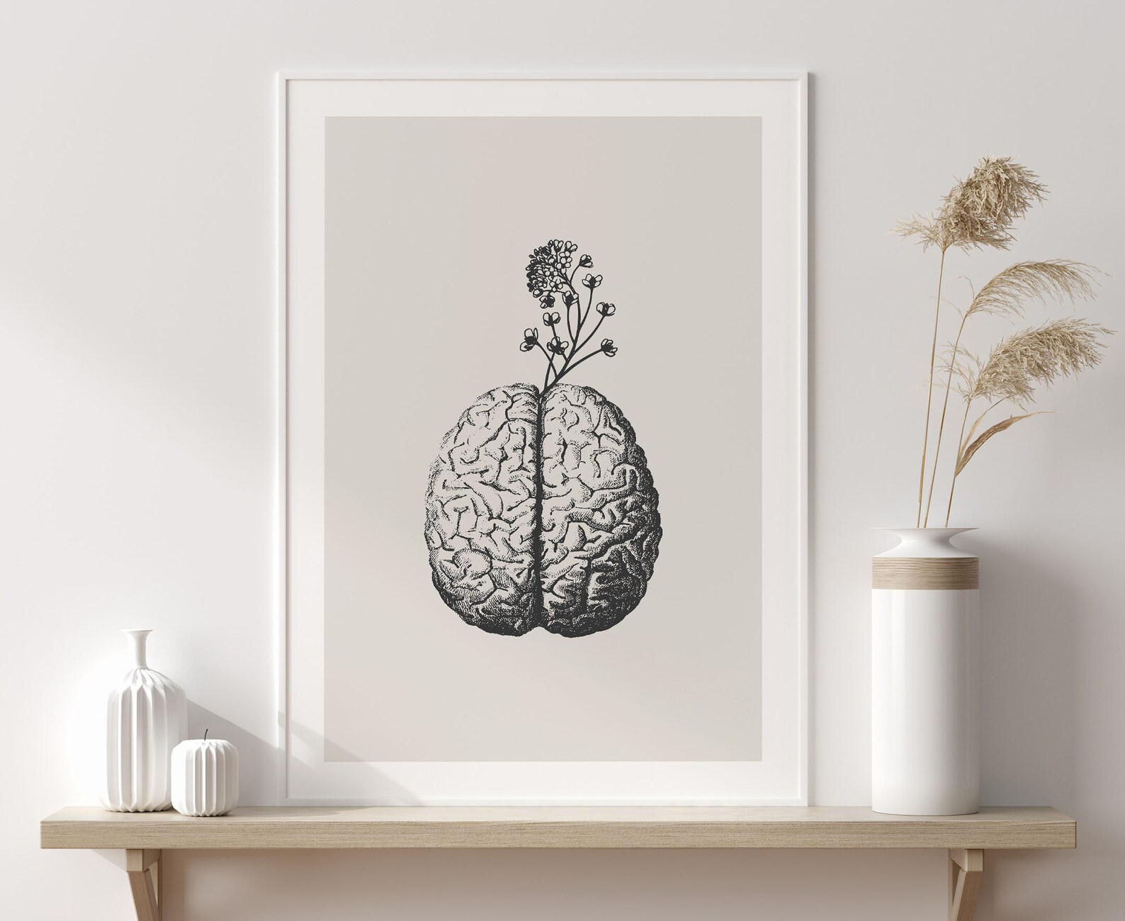 BRAIN BLOOM Brain Art Clinic Decor Anatomy Poster - Etsy