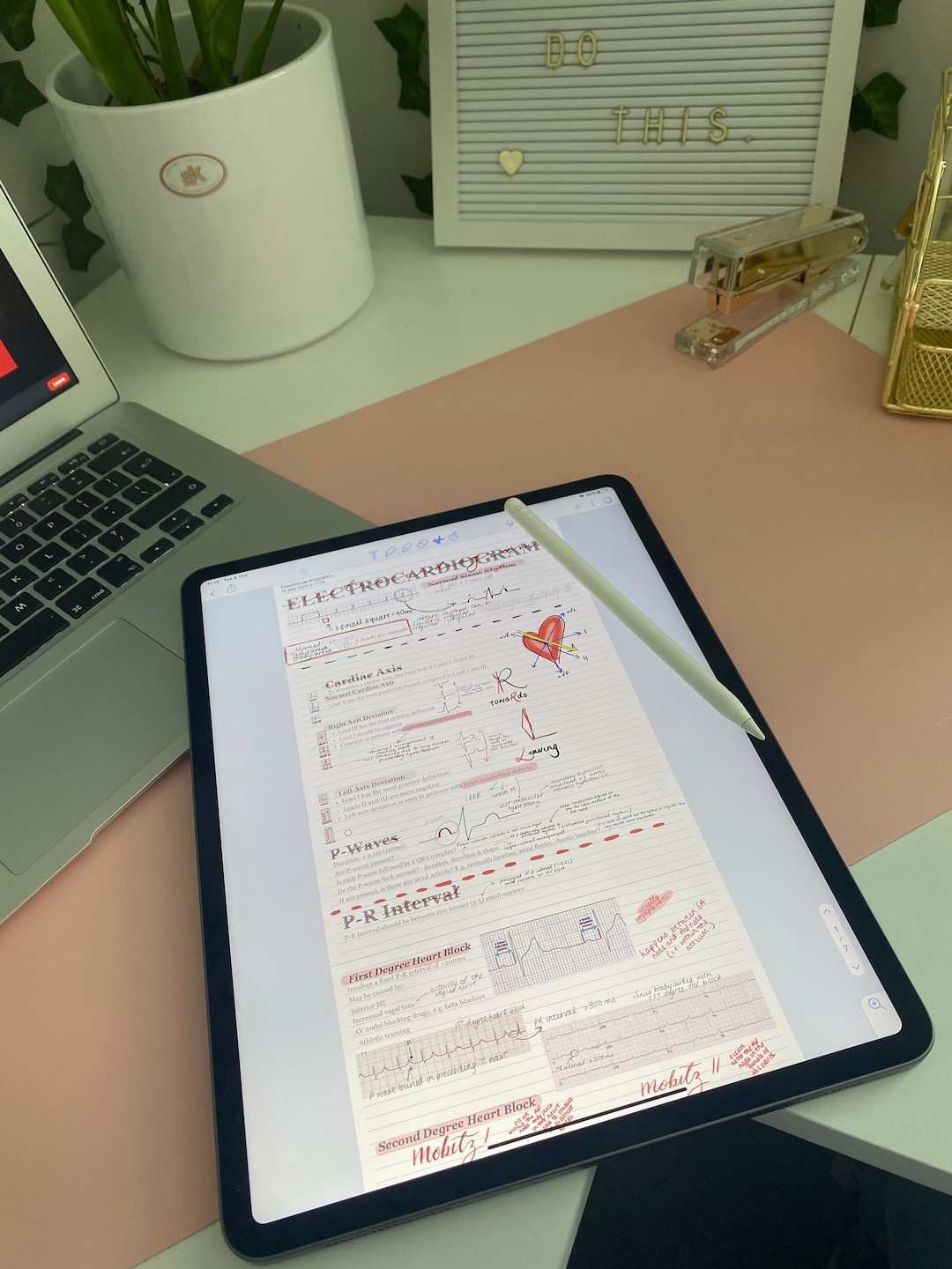 ECG/EKG Digital Notes - Etsy