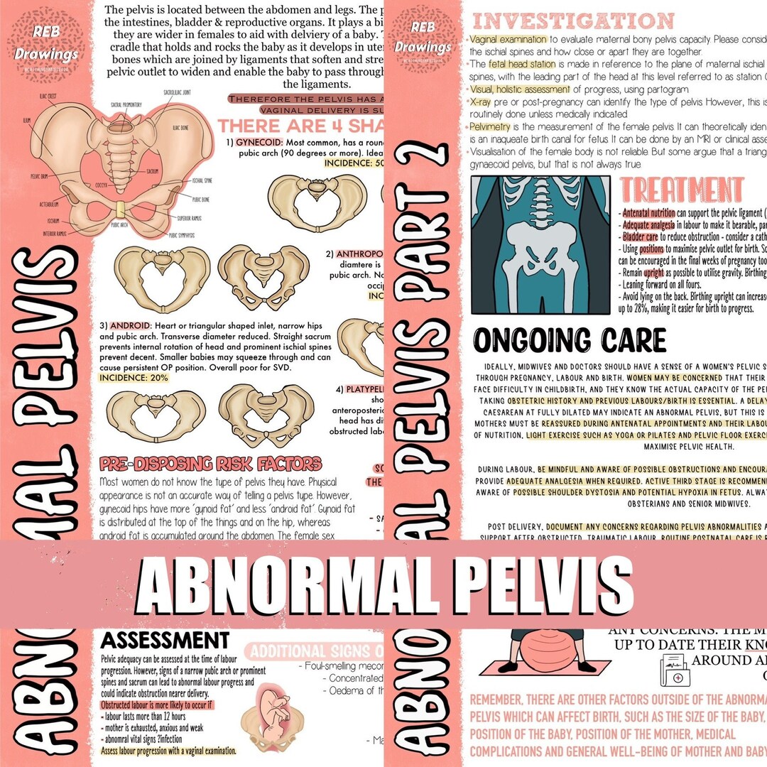Abnormal Pelvis Pregnancy Poster - Etsy