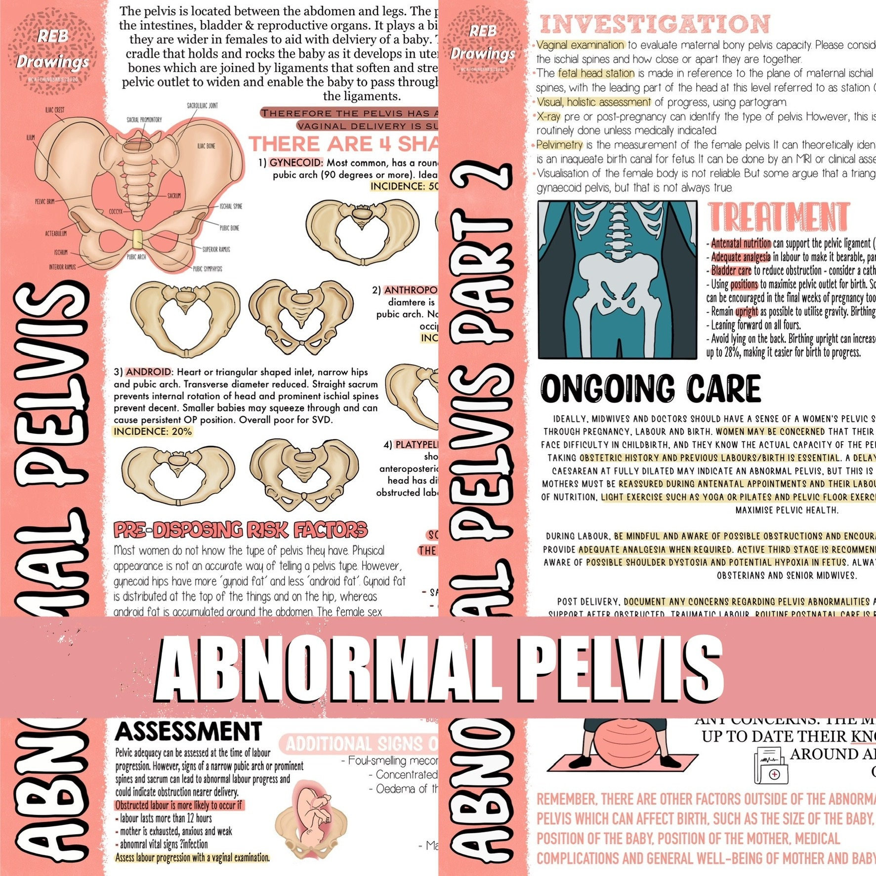 Abnormal Pelvis Pregnancy Poster - Etsy
