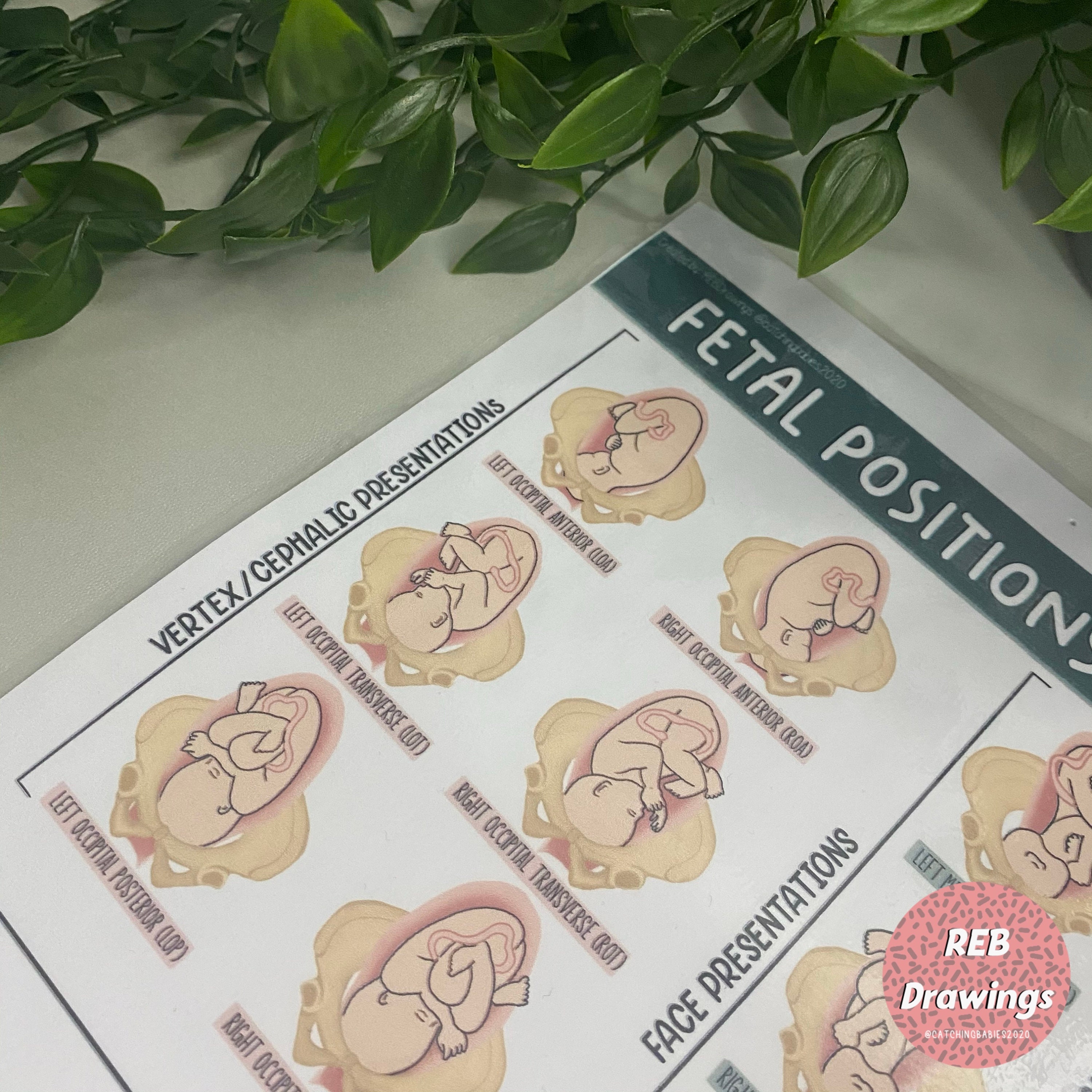 Fetal Presentations Poster - Etsy UK