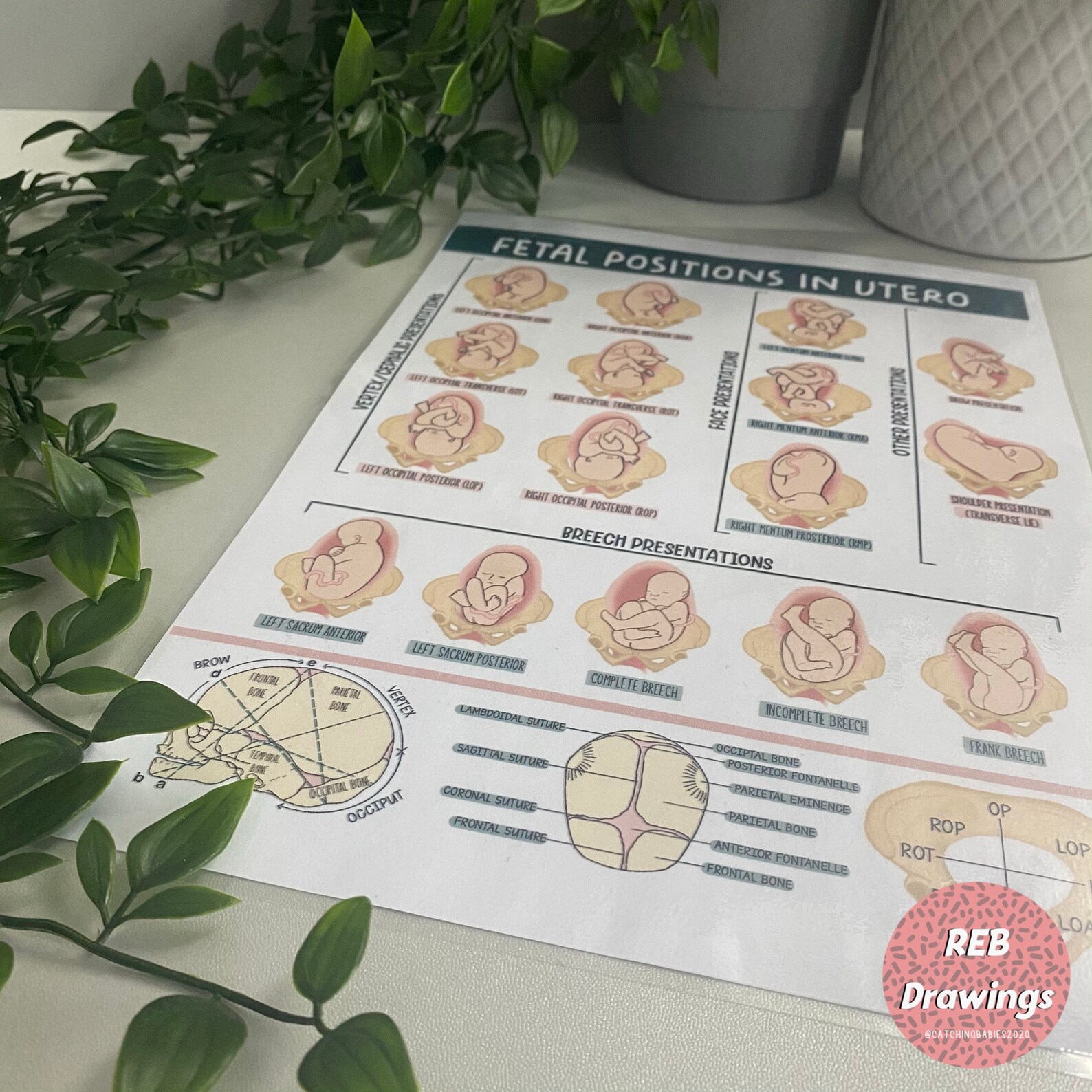 Fetal Presentations Poster - Etsy Australia