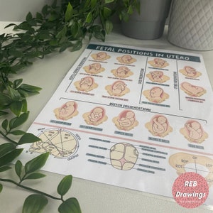 Fetal Presentations Poster - Etsy