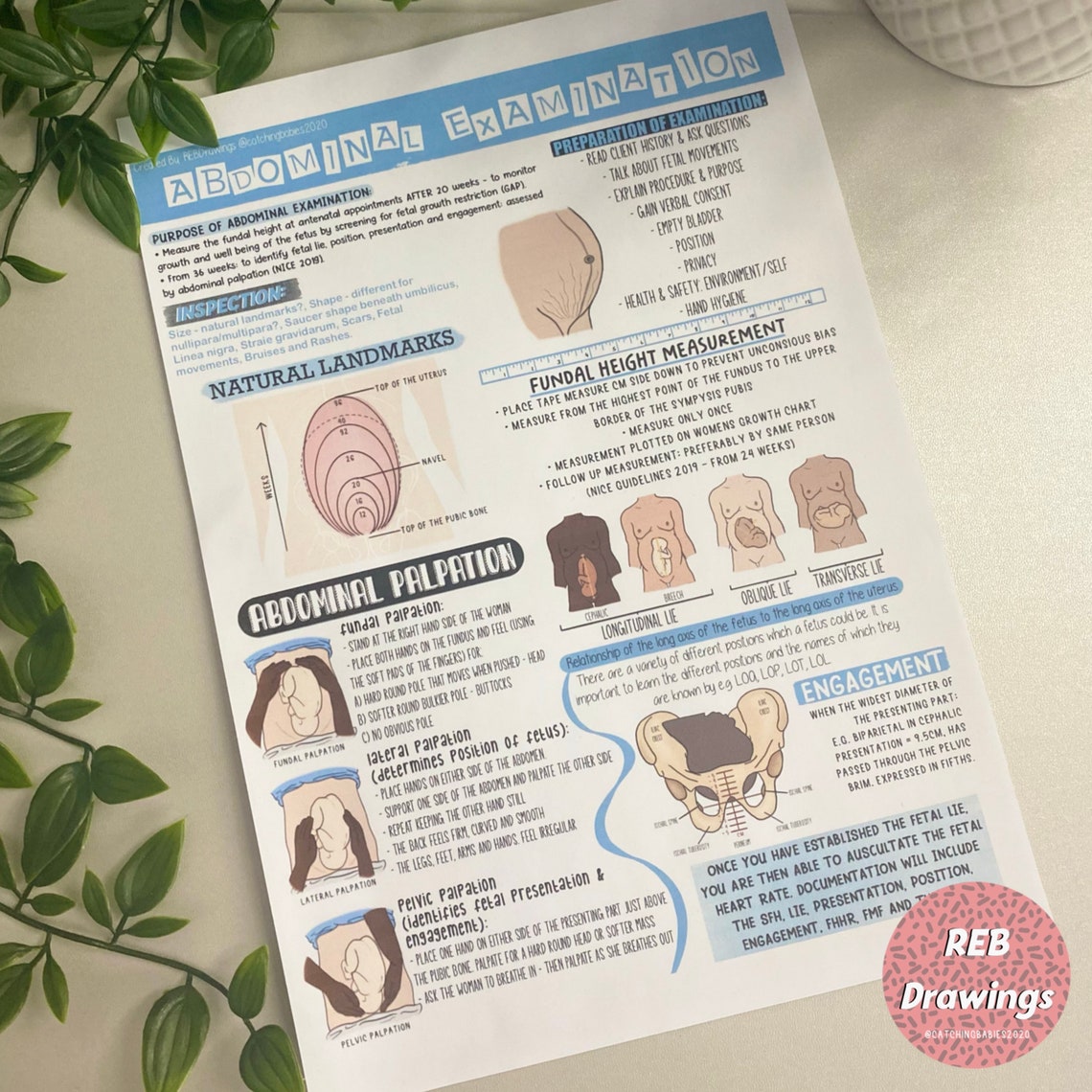 Abdominal Examination Revision Poster | Etsy