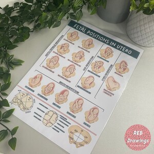 Fetal Presentations Poster - Etsy