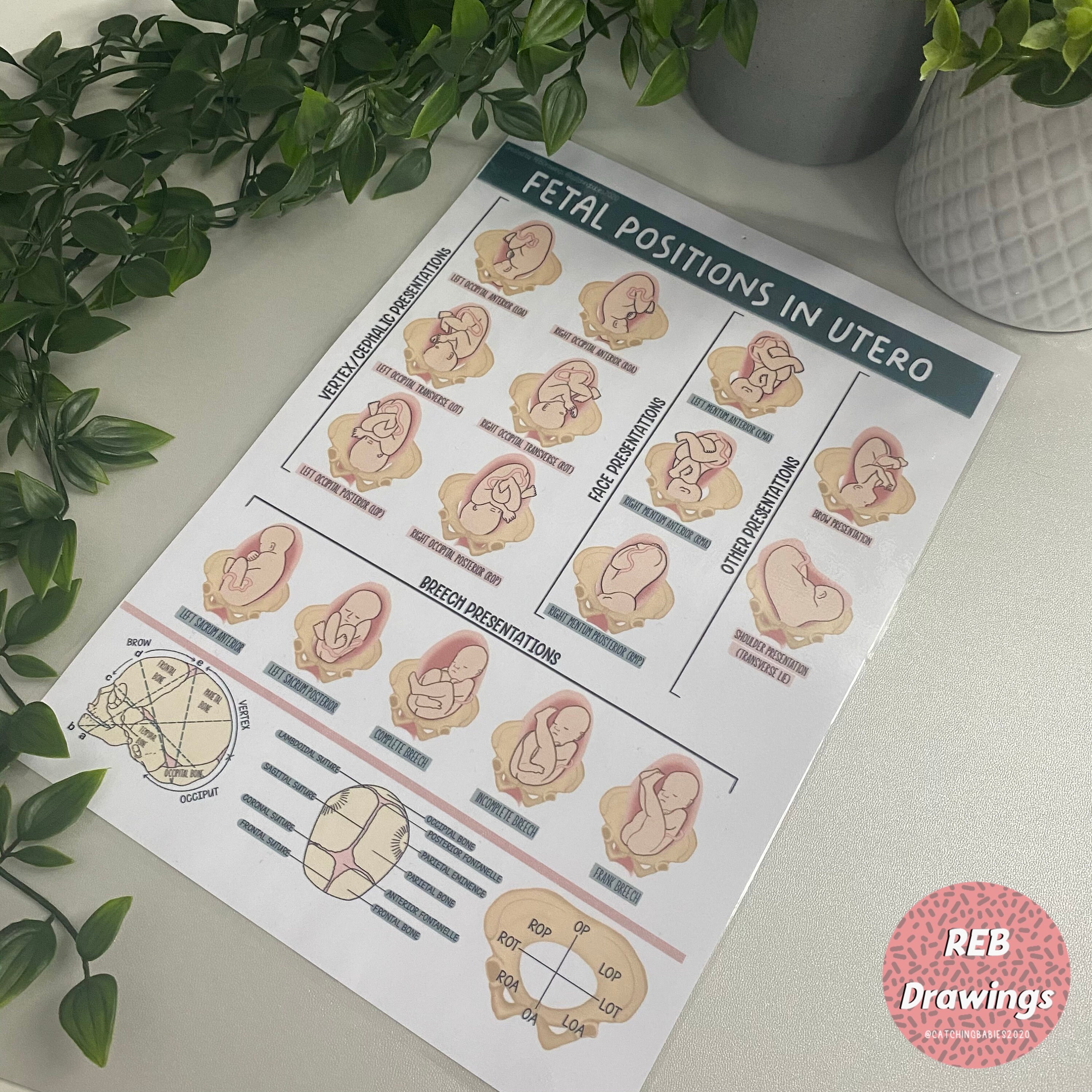 Fetal Presentations Poster - Etsy Canada