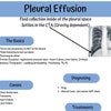 Flail Chest Nursing School Notes, Med Surg Pulmonary Basics, Flail ...