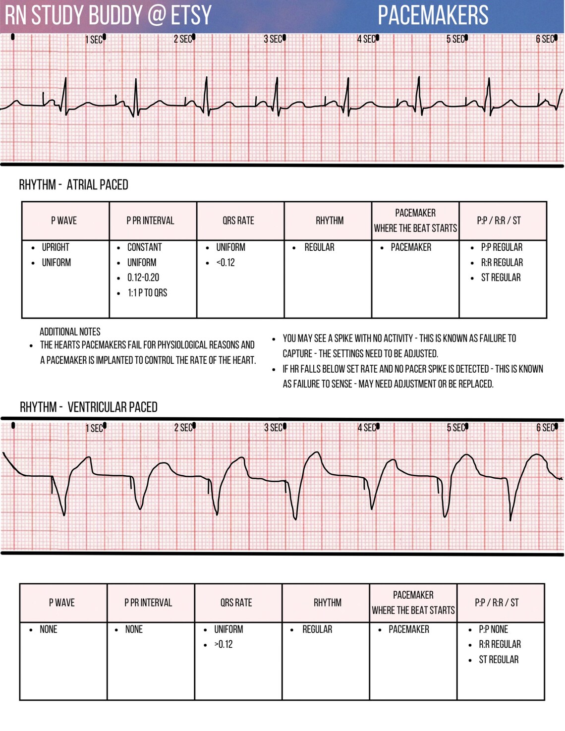 38 Pages Easy EKG and Master the Basics Like Heart Blocks, Help With ...