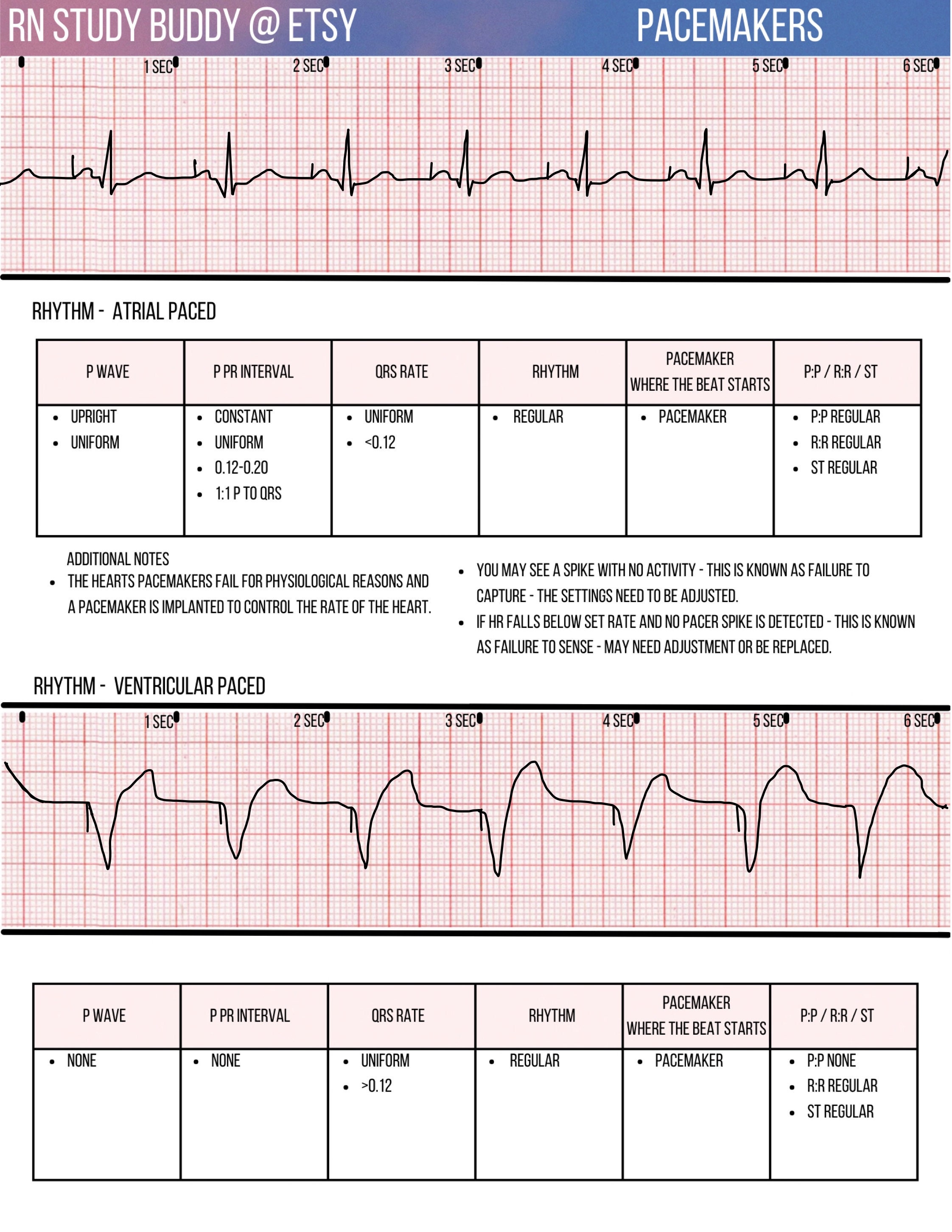 38 Pages Easy EKG and Master the Basics Like Heart Blocks, Help With Junctional Rhythms ...
