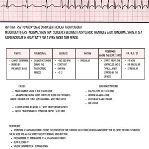 38 Pages Easy EKG and Master the Basics Like Heart Blocks, Help With Junctional Rhythms ...