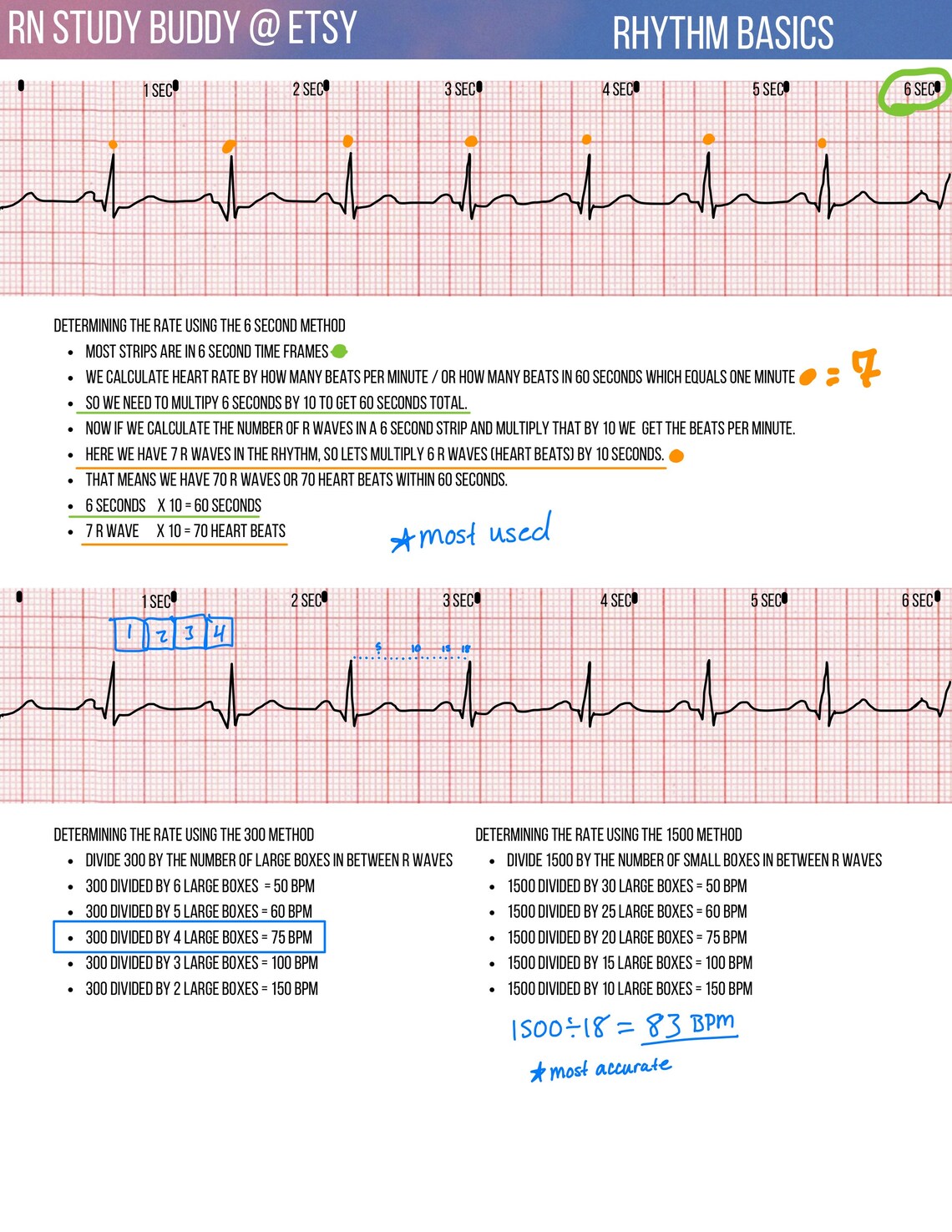 38 Pages Easy EKG and Master the Basics Like Heart Blocks, Help With Junctional Rhythms ...