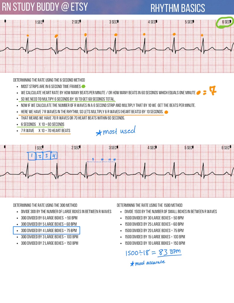 38 Pages Easy EKG and Master the Basics Like Heart Blocks, Help With ...