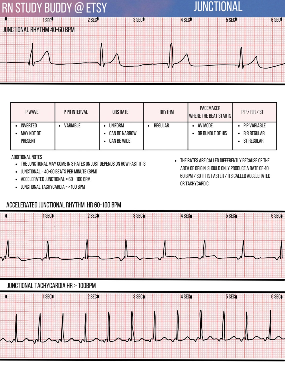 38 Pages Easy EKG and Master the Basics Like Heart Blocks, Help With ...